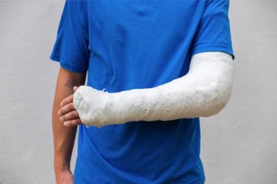 Fracture & Plaster – Khera Hospital